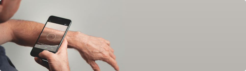 SkinVision | Skin Cancer Melanoma Detection App | SkinVision