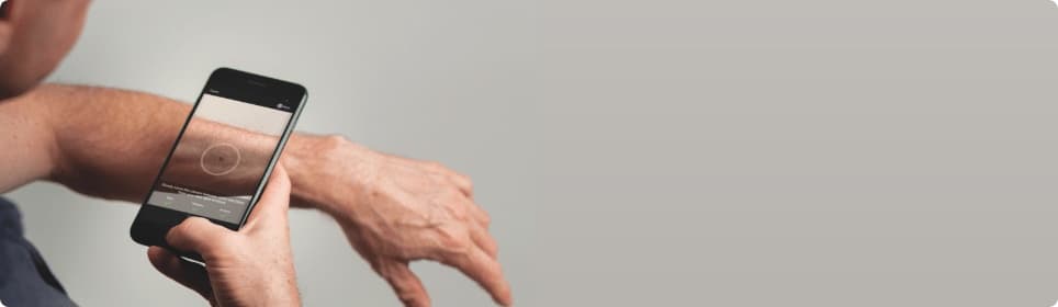 The most common skin lesions (benign) | With Pictures